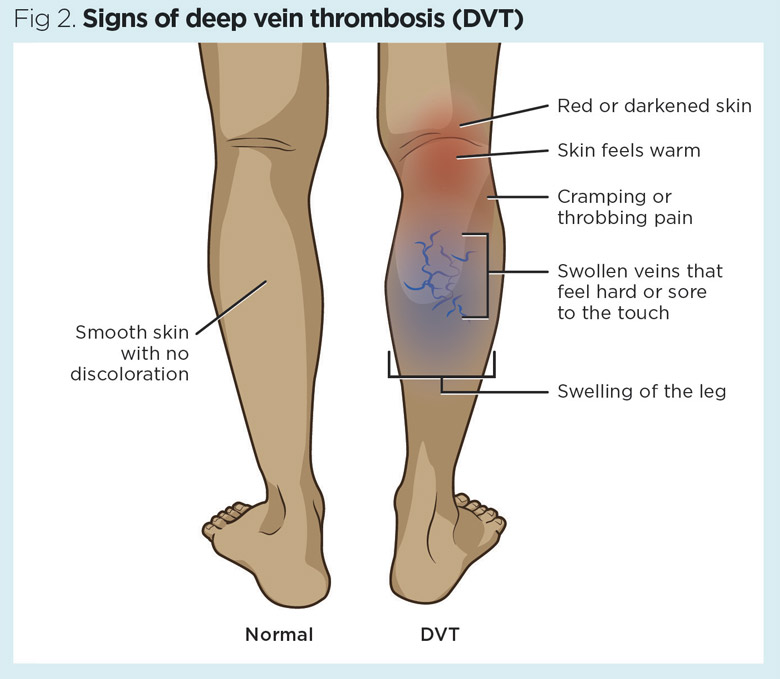 How to optimise care of a patient undergoing knee replacement surgery ...